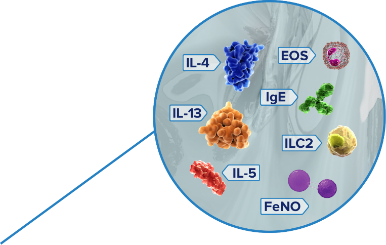 Type 2 Inflammation in Asthma