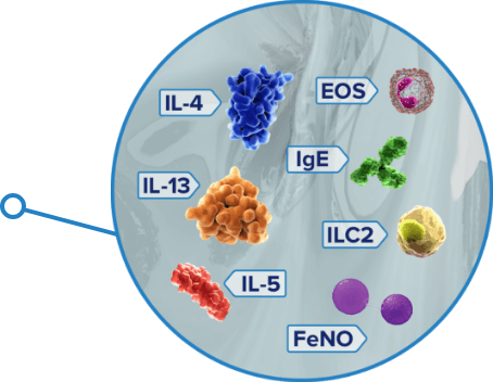 Type 2 Inflammation in Asthma