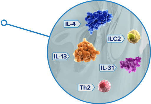 Type 2 Inflammation in Atopic Dermatitis