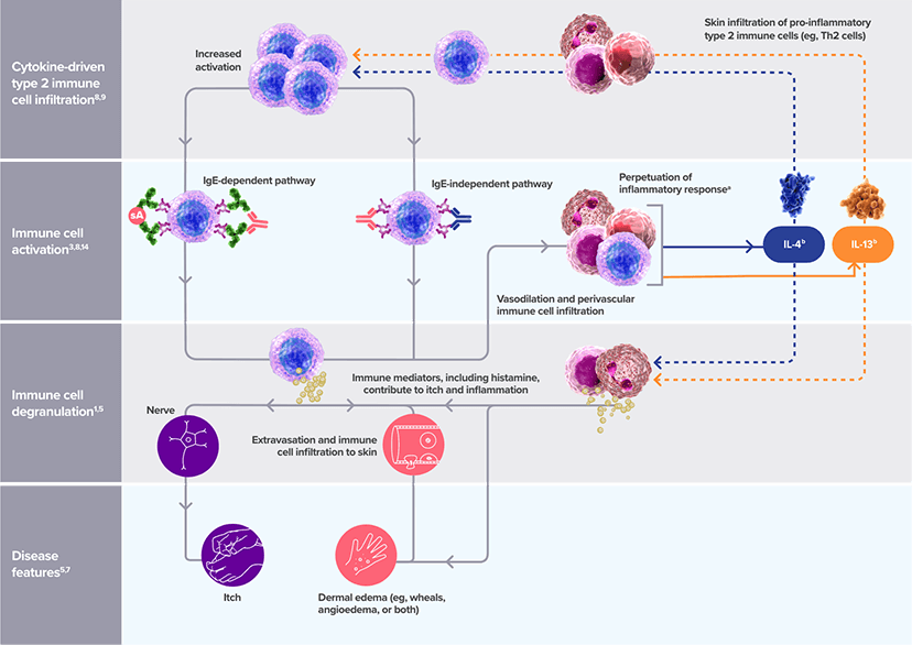 Discover Type 2 Inflammation in CSU